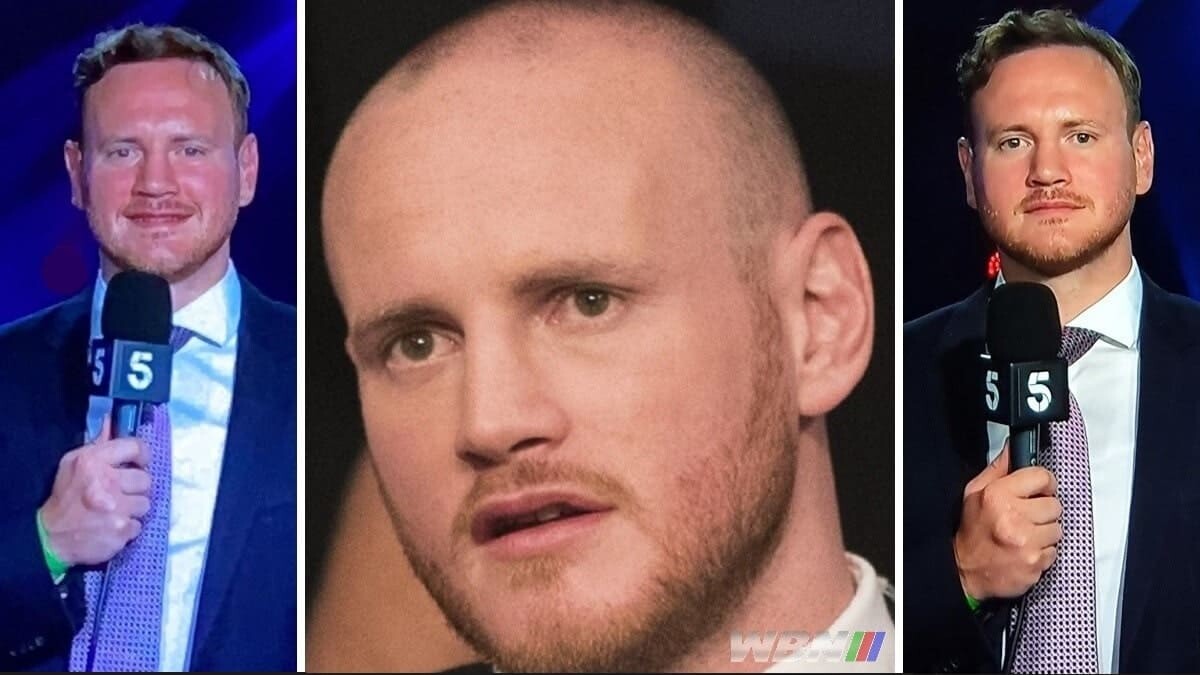 George Groves weight gain and hair transplant discombobulates