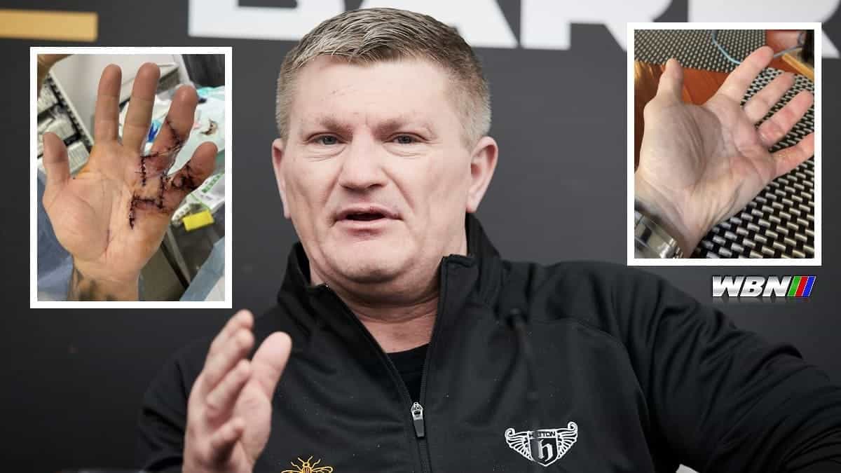 Fans worried as Ricky Hatton disease linked to high alcohol use - World ...