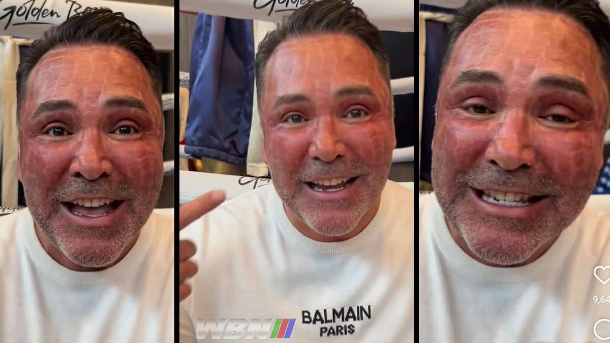 Oscar De La Hoya correctly bailed from comeback beast Vitor Belfort - World Boxing News