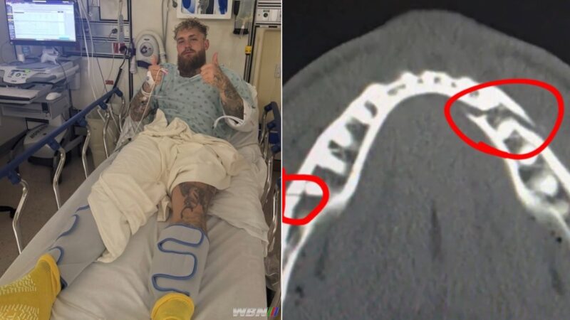 Jake Paul Isn’t Banned: Understanding Post-Fight Boxing Suspensions